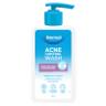 Buy Dermal Therapy Acne Control Wash 175ml online at Chemist Warehouse