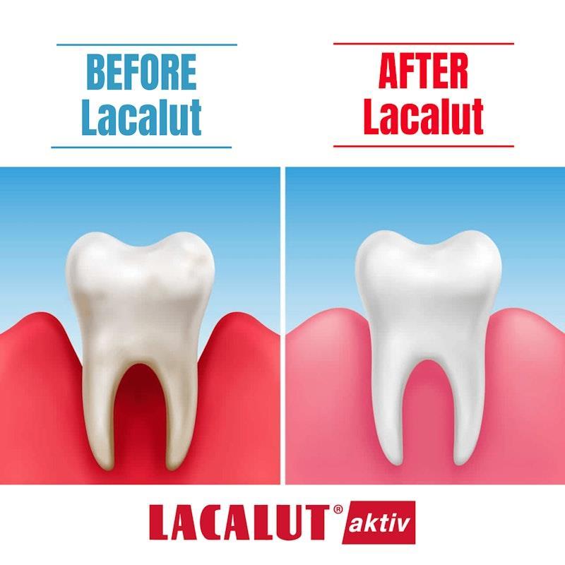 Buy Lacalut Activ. German Gum Repair, Anti-Gingivitis Toothpaste - 6 ...