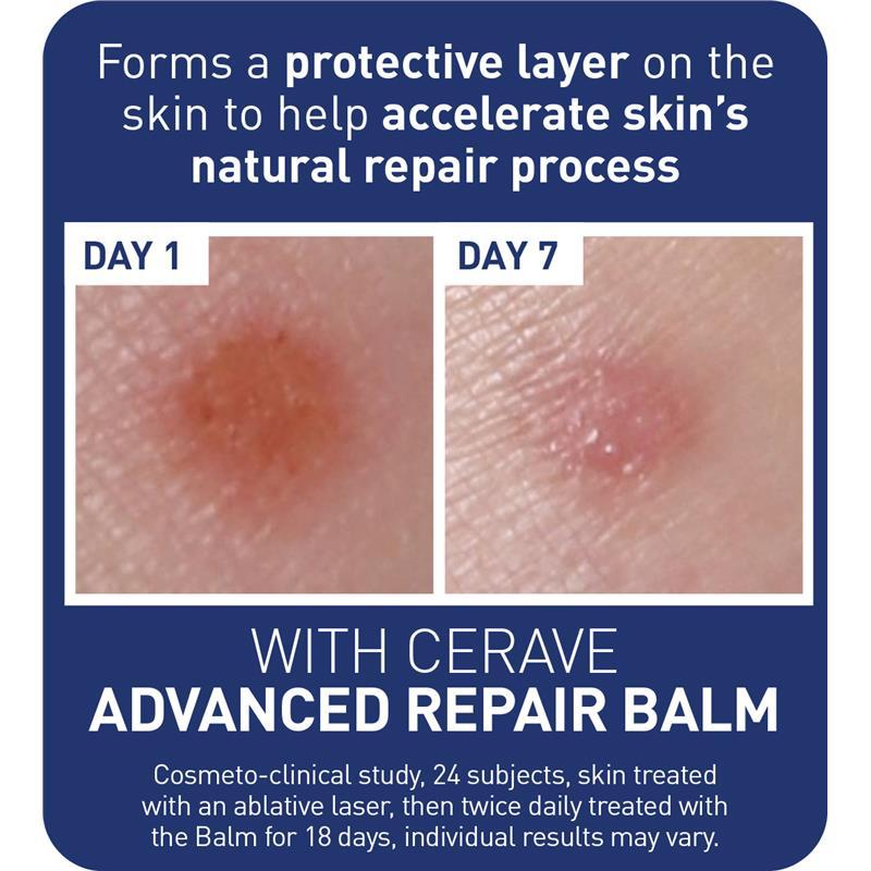 Buy CeraVe Advanced Repair Balm 50ml online at Chemist Warehouse