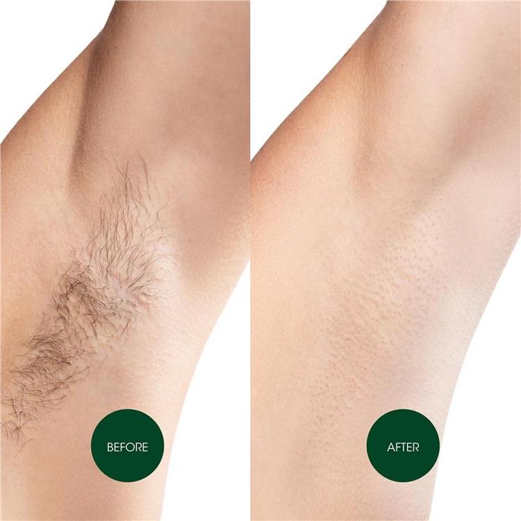 Buy Nad's Body Wax Strips 20 online at Chemist Warehouse